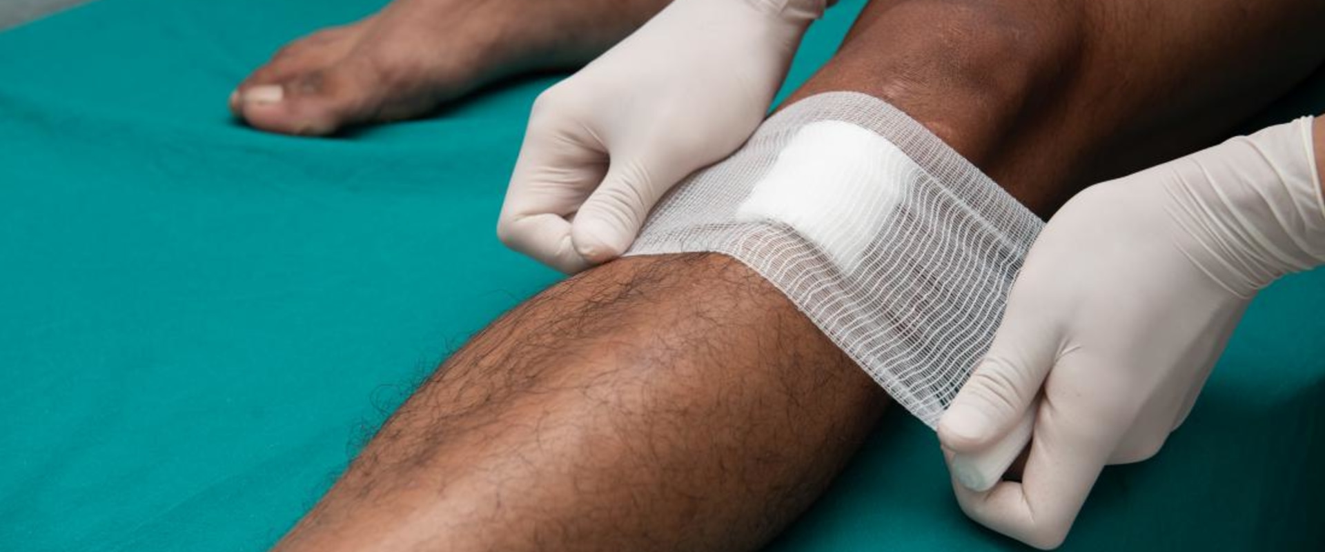 The Ultimate Guide to Wound Dressings: Types, Uses, and Recommendations