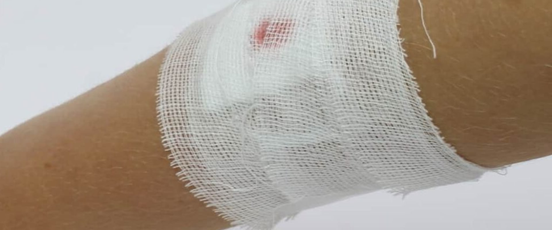 The Versatile and Essential Role of Gauze Bandages in Wound Care