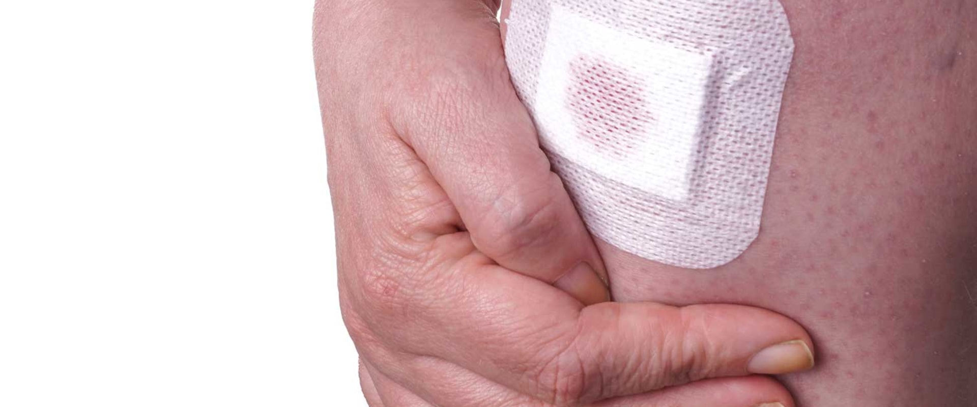 The Role of Gauze in Advanced Wound Care
